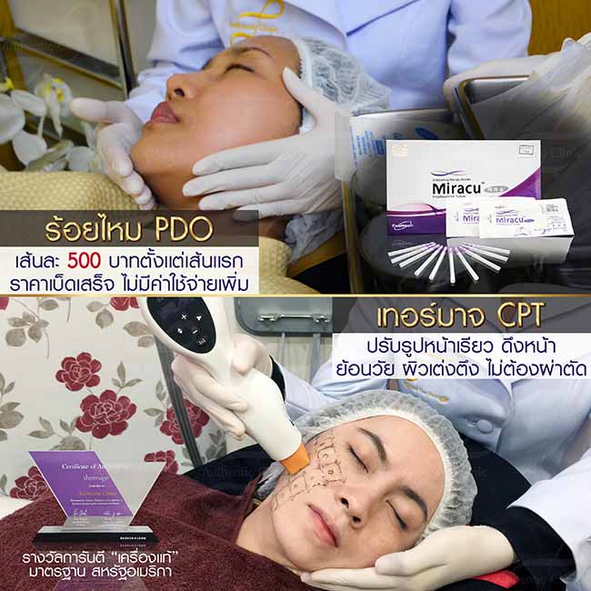 PDO THERMAGE JUN | Authentic Clinic คลินิก ให้บริการด้านความงาม และผิวพรรณ ด้วยเทคโนโลยีที่ทันสมัย