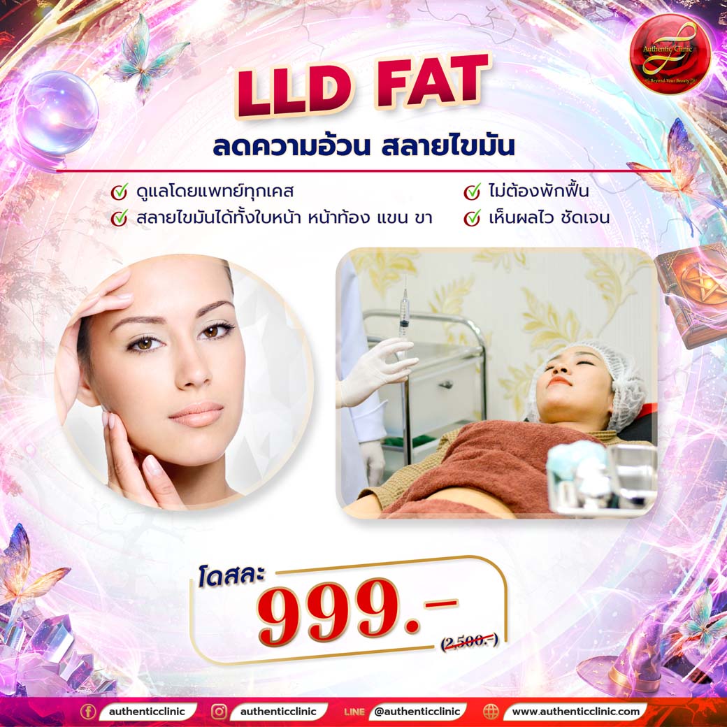 💎โปรโมชั่นประจำเดือน💎