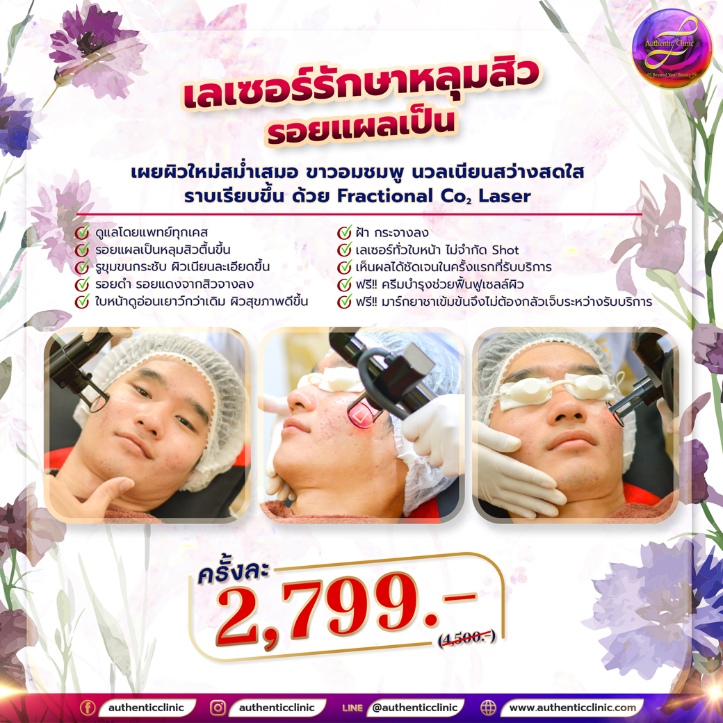 Miracle Silky Skin | Authentic Clinic คลินิก ให้บริการด้านความงาม และผิวพรรณ ด้วยเทคโนโลยีที่ทันสมัย