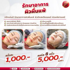 Miracle Rash Treatment | Authentic Clinic คลินิก ให้บริการด้านความงาม ...
